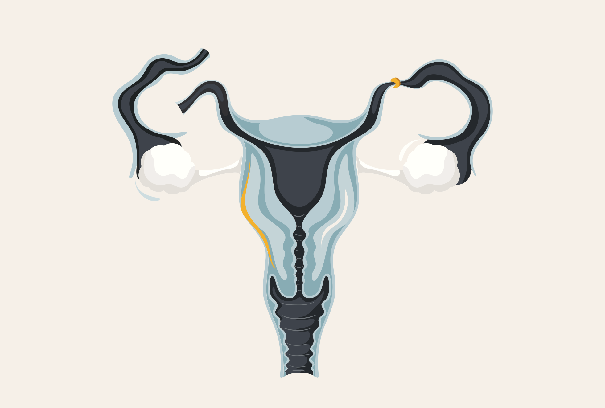 Empowering Choices: Exploring Permanent Birth Control Options for Women