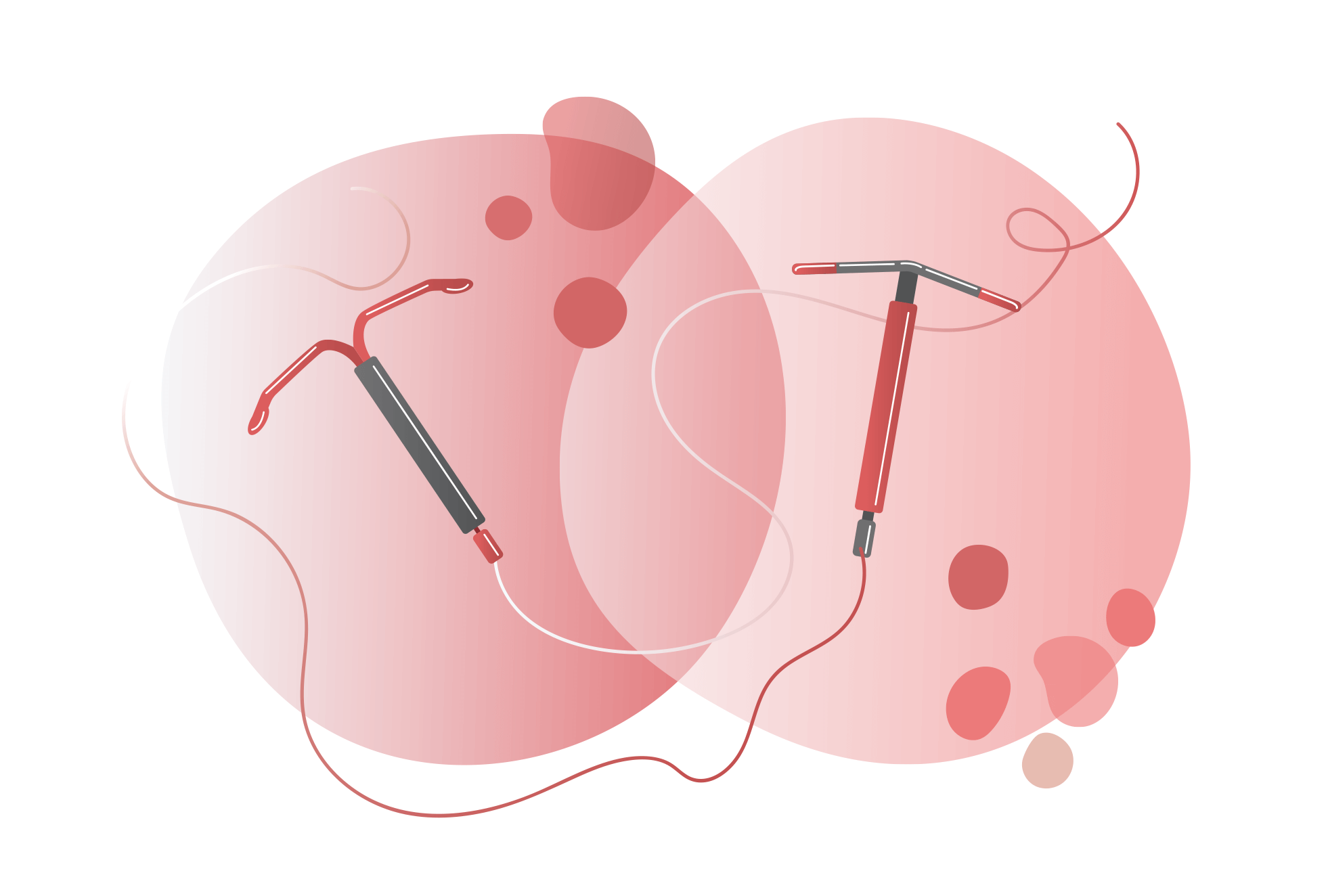 Hormonal and Non-Hormonal IUDs: Comparison of Benefits, Possible Side ...